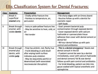 Trauma dental sehari-hari 122345678.pptx