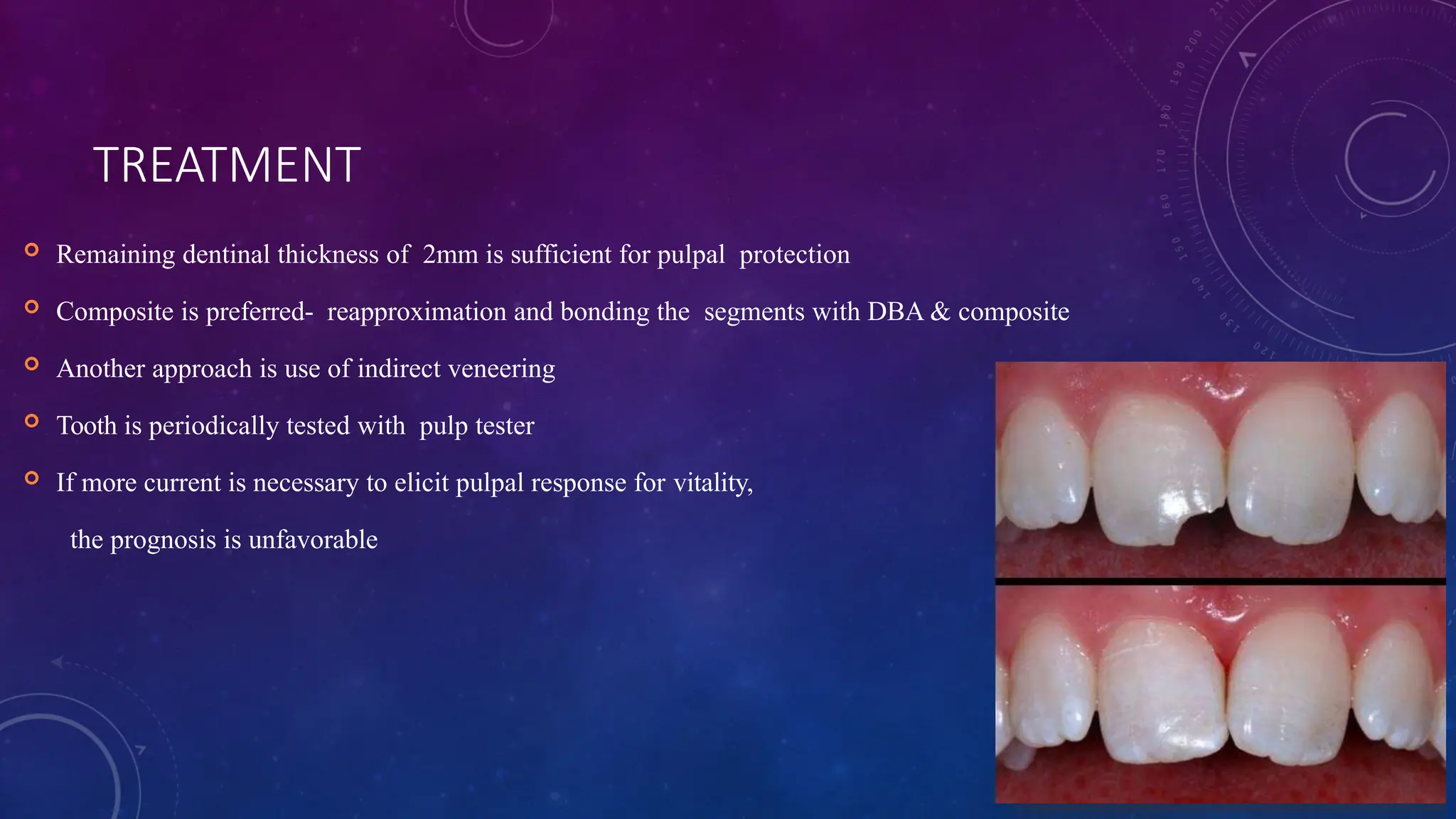 DENTAL TRAUMATIC INJURIES in patient.pptx