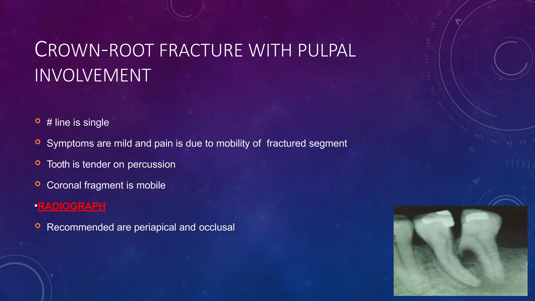 DENTAL TRAUMATIC INJURIES in patient.pptx