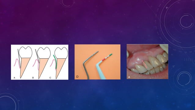 DENTAL TRAUMATIC INJURIES in patient.pptx