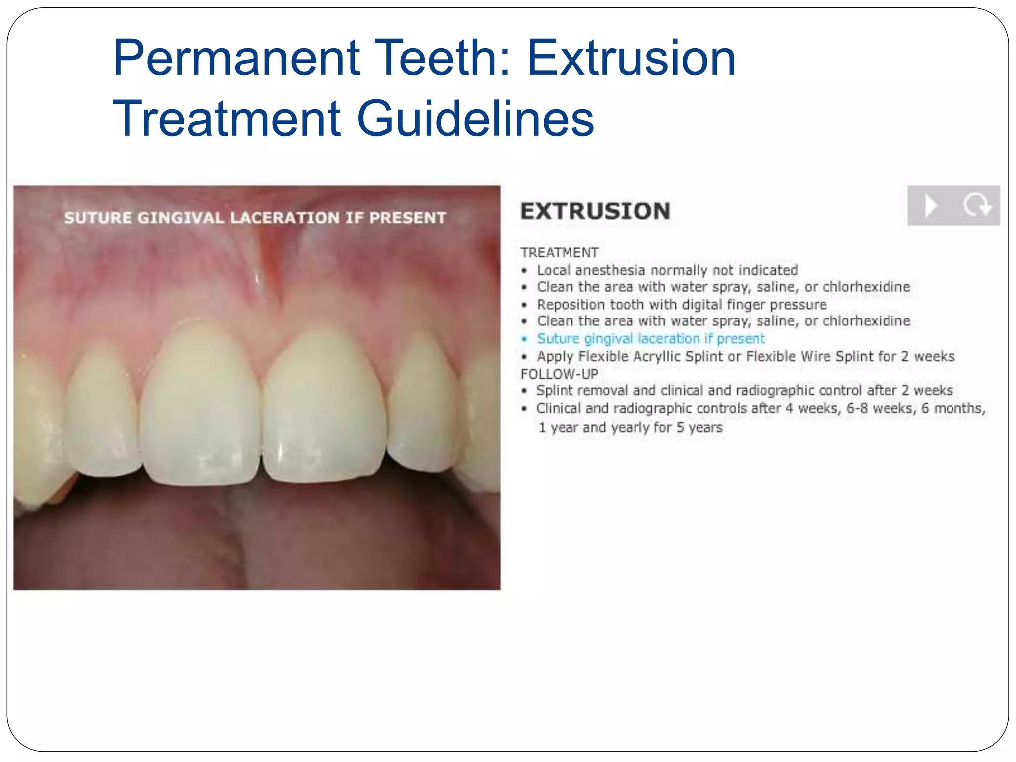 Dental trauma to permanent teeth | PPTX