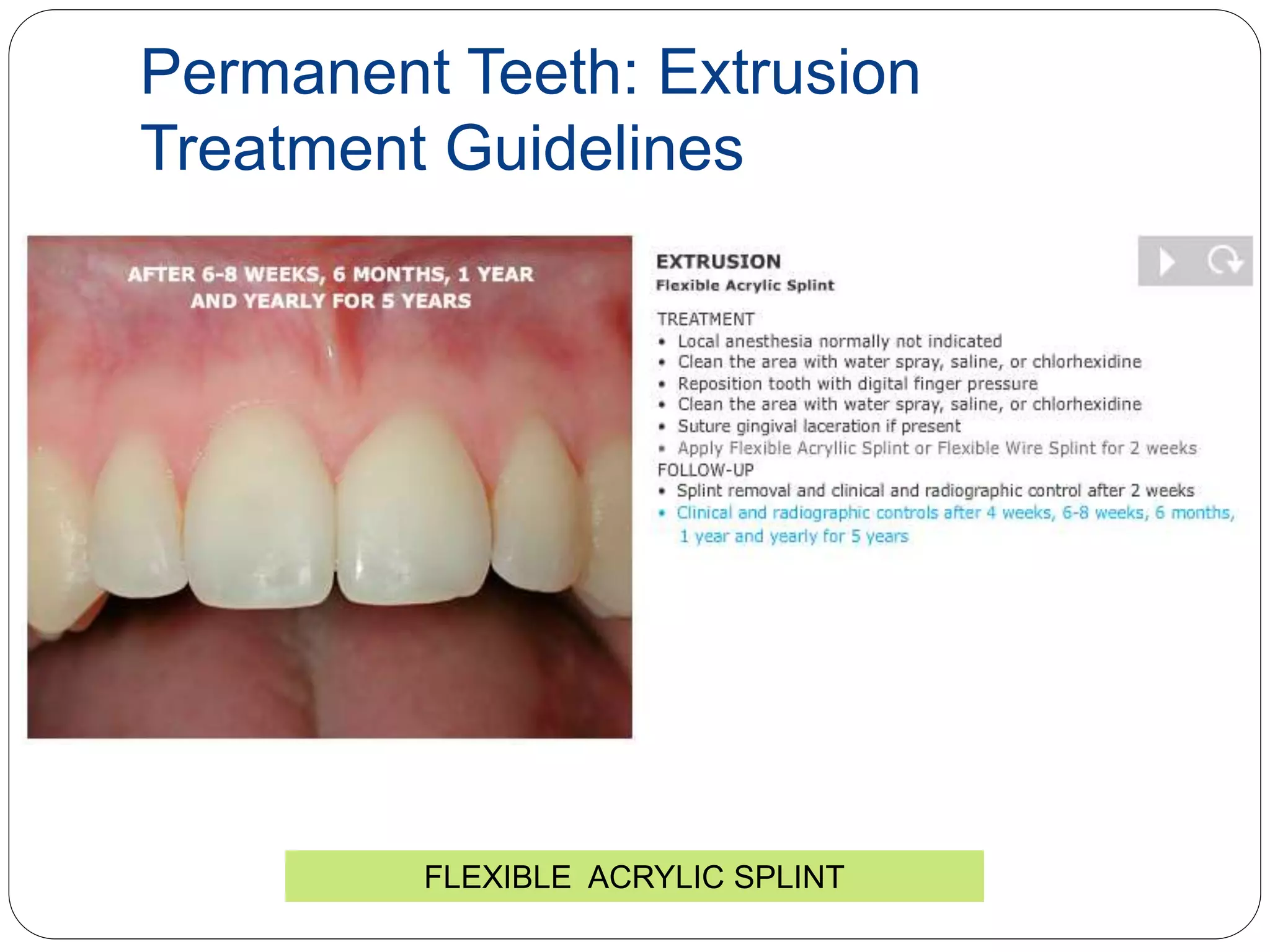 Dental trauma to permanent teeth | PPTX