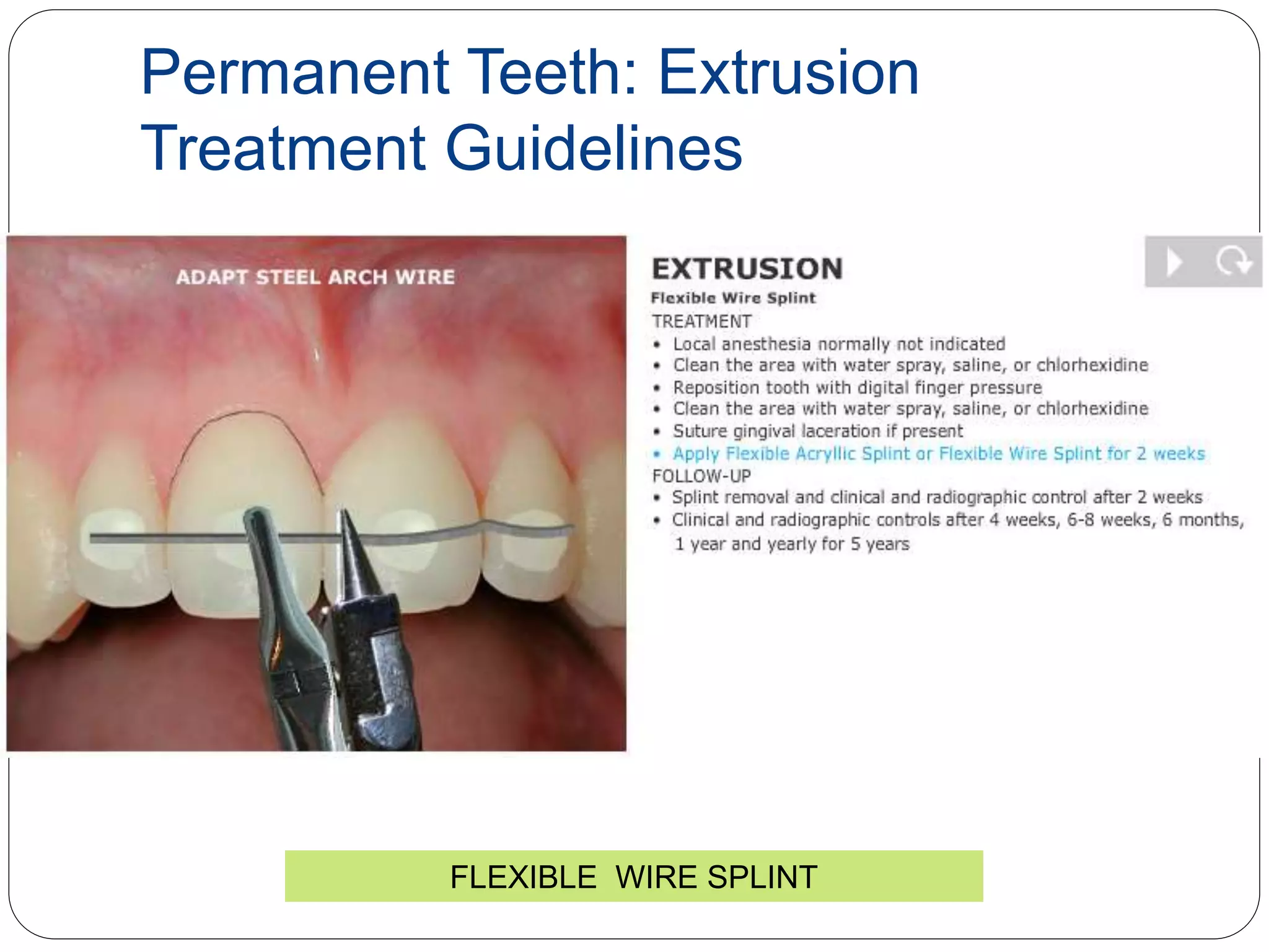 Dental trauma to permanent teeth | PPTX