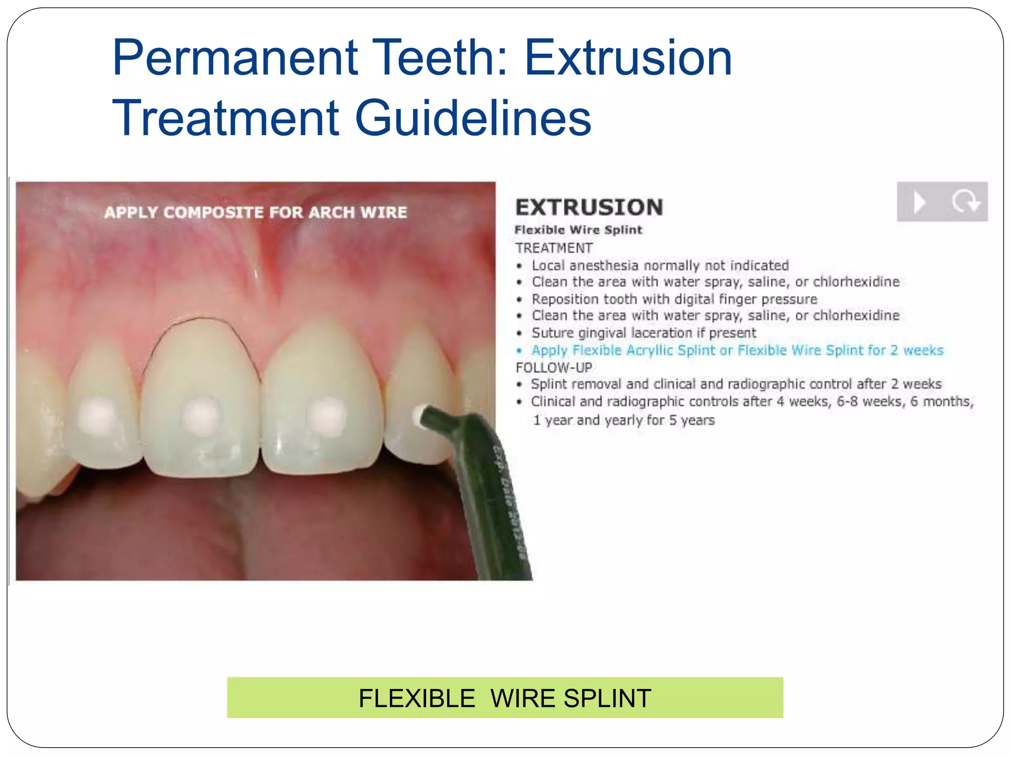 Dental trauma to permanent teeth | PPTX