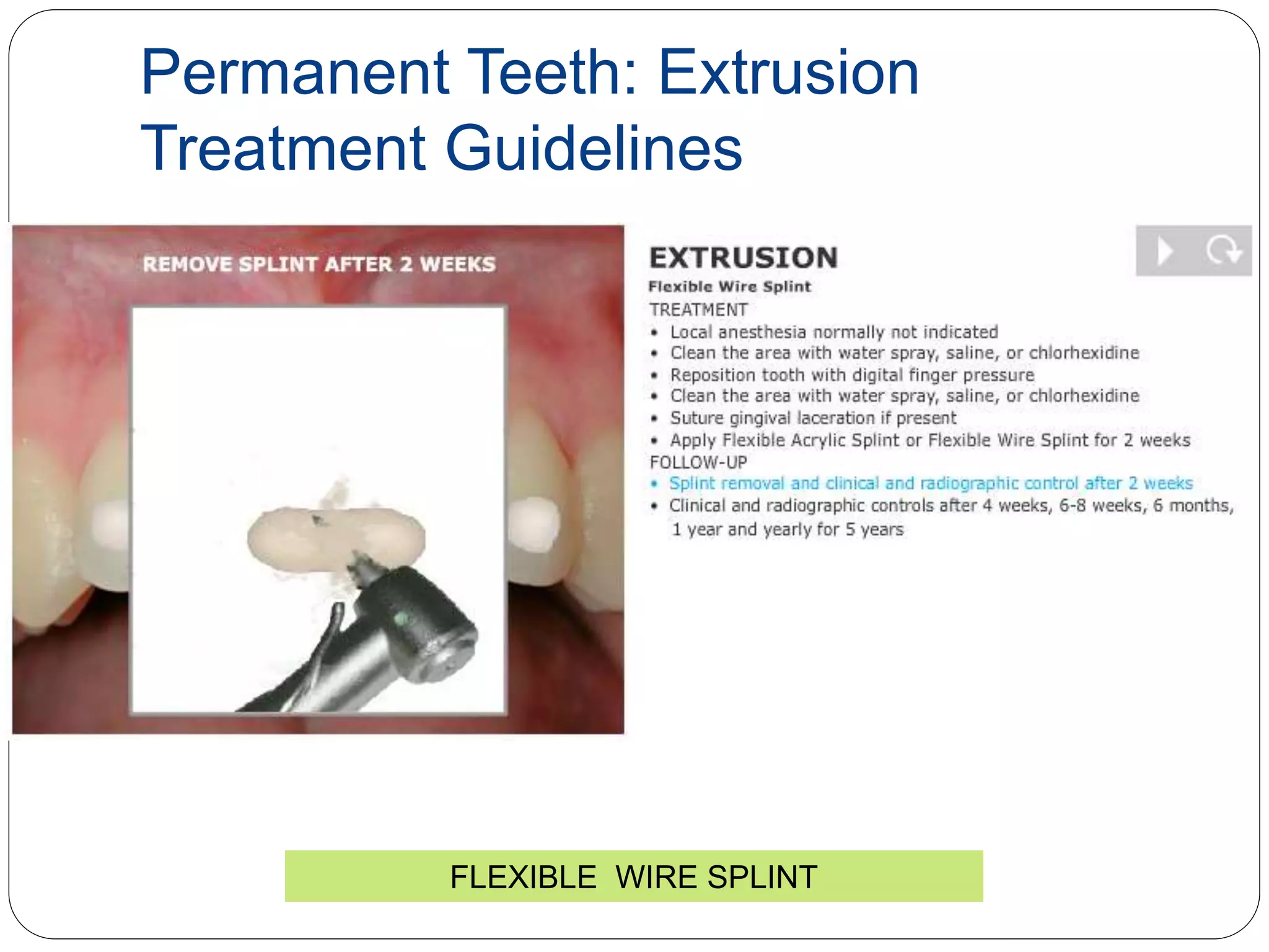 Dental trauma to permanent teeth | PPTX