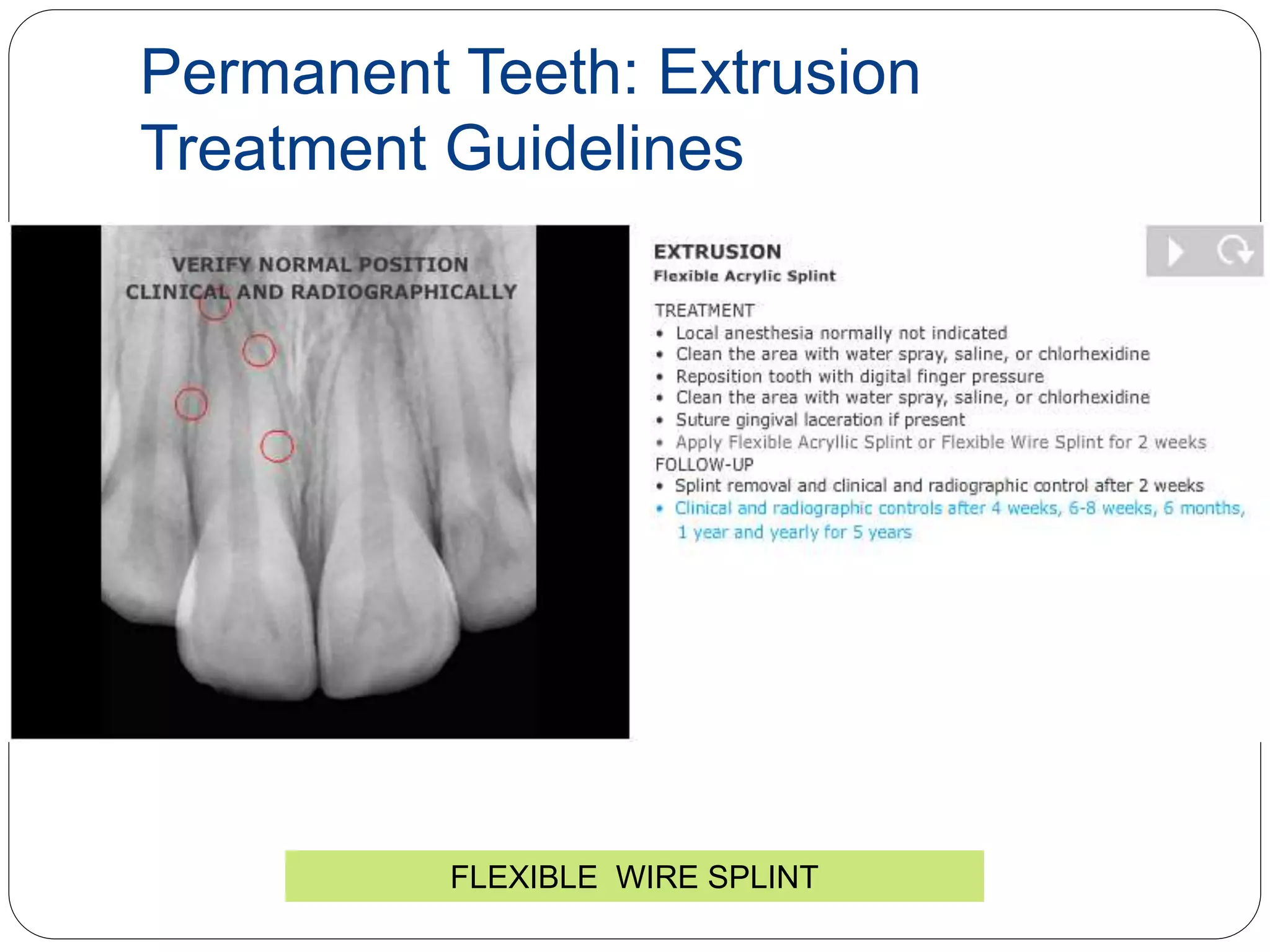 Dental trauma to permanent teeth | PPTX