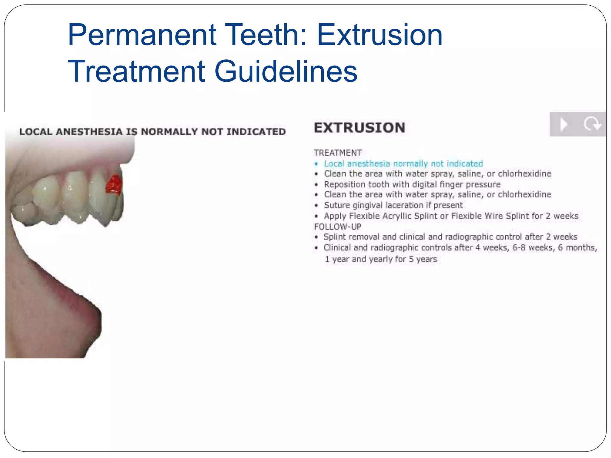 Dental trauma to permanent teeth | PPTX