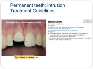Tooth Intrusion