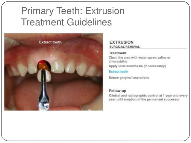 Dental trauma to primary teeth