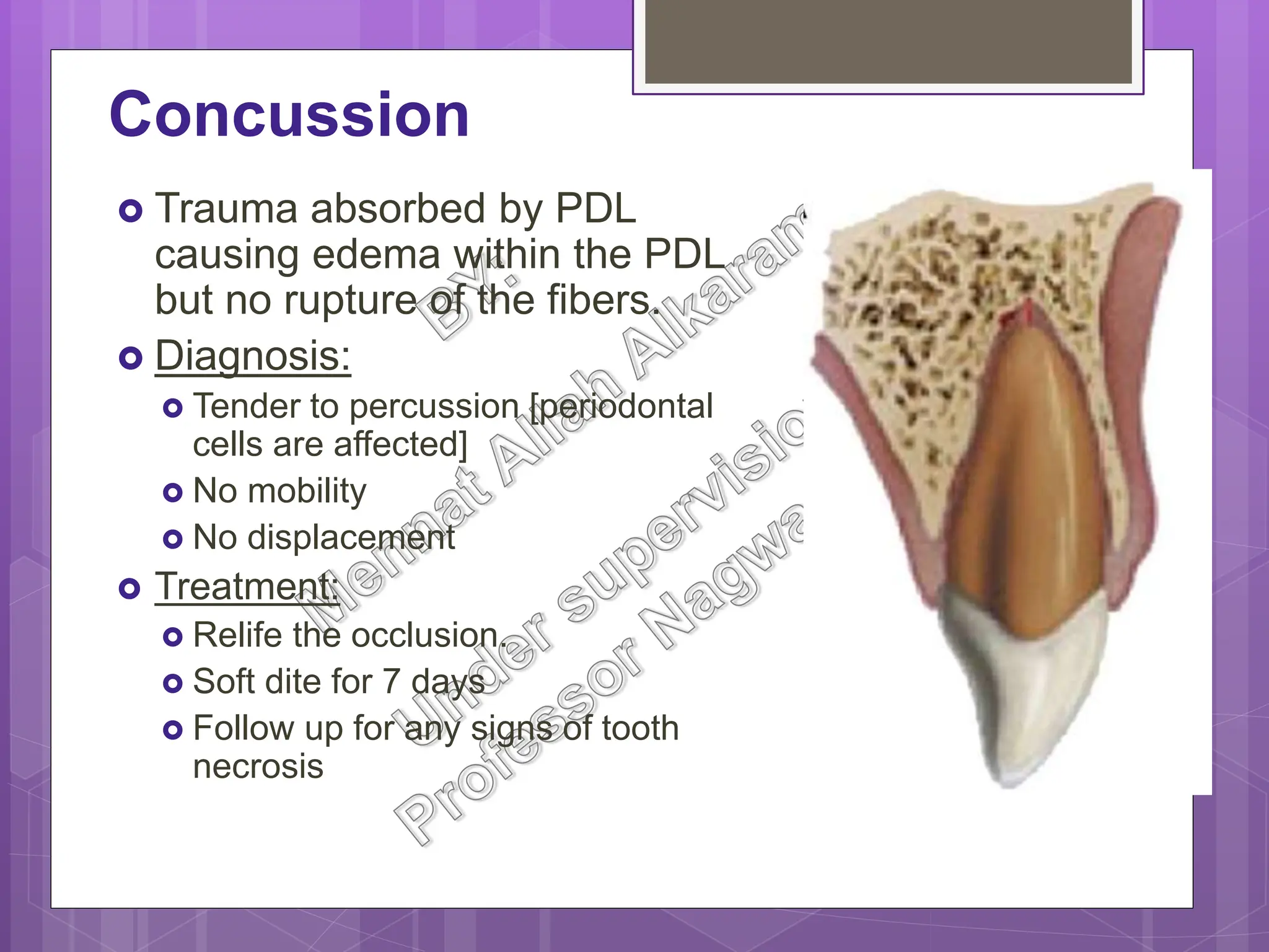 management of traumatic dental injuries in children.pptx