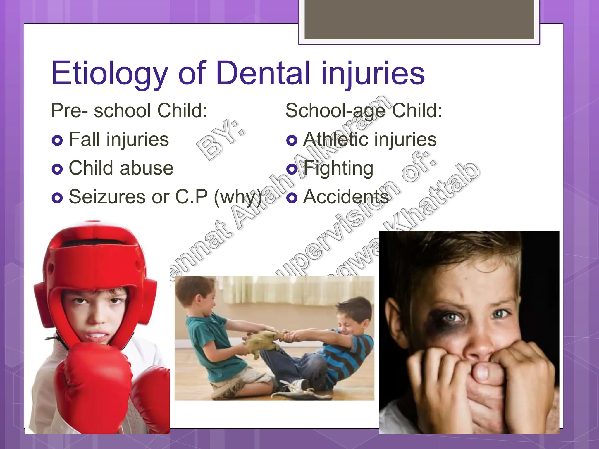 management of traumatic dental injuries in children.pptx