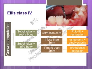 management of traumatic dental injuries in children.pptx