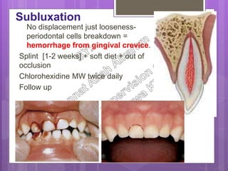 management of traumatic dental injuries in children.pptx