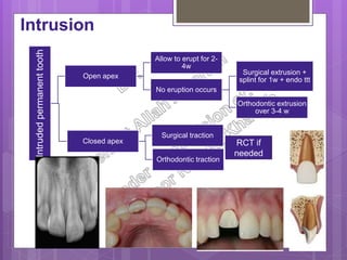 management of traumatic dental injuries in children.pptx