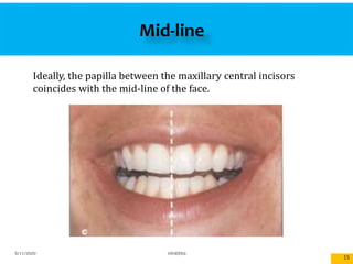Dental veneer | PPTX