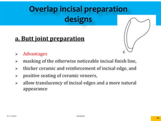 Dental veneer | PPTX