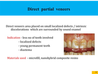 Dental veneer | PPTX