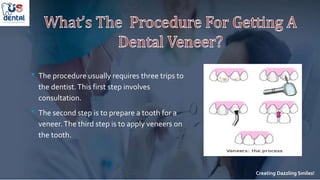 Dental Veneers | PPT