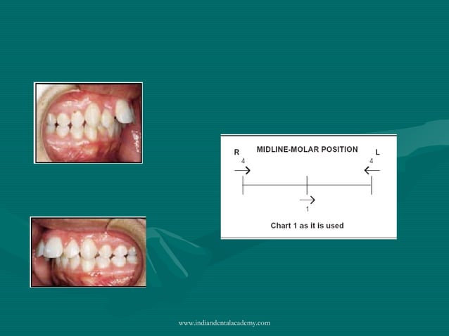 Dental VTO | PPT