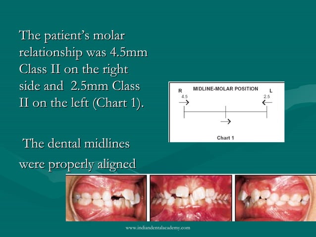 Dental VTO | PPT