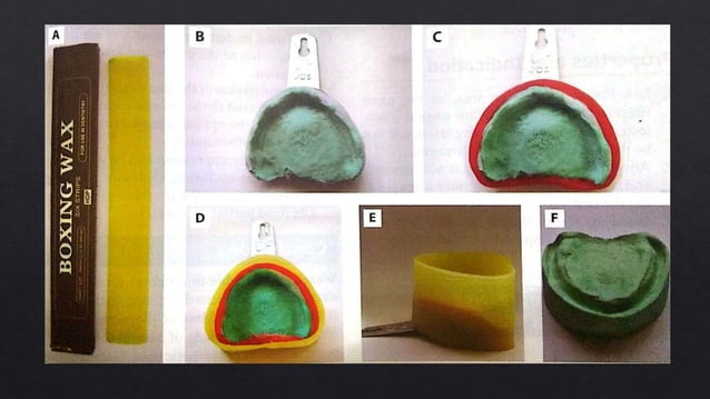 Dental waxes | PPT