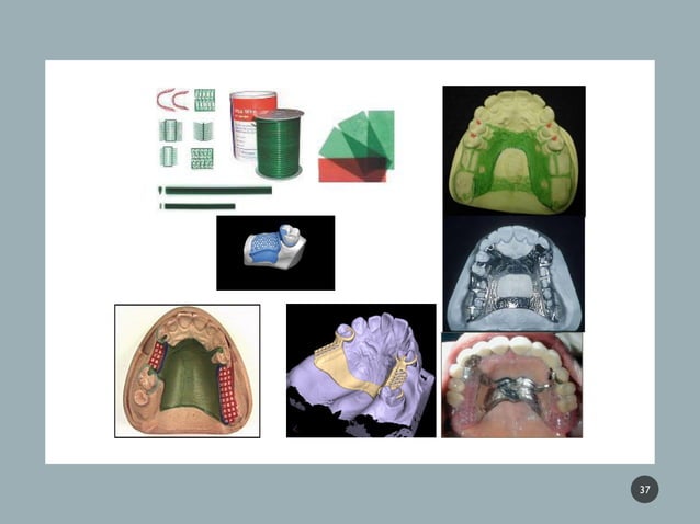 Dental Waxes notes .....................Dental Waxes notes ...