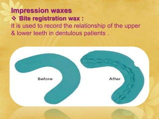 Dental waxes\dental materials ppt | PPTX