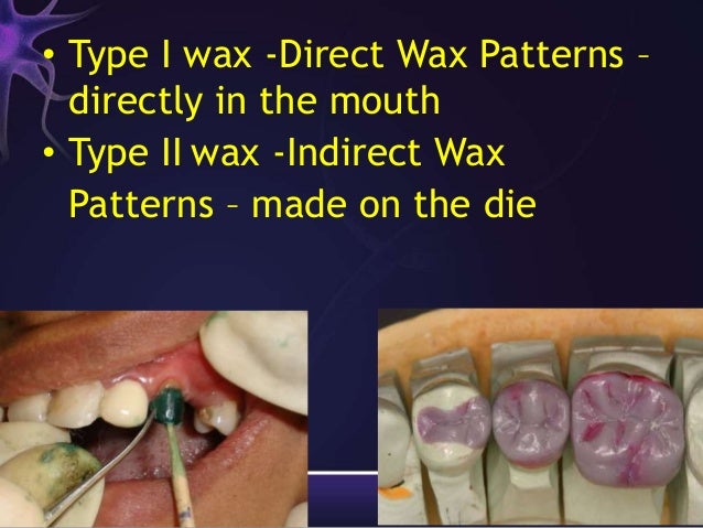 Dental waxs