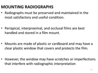 Dental x ray film processing | PPTX