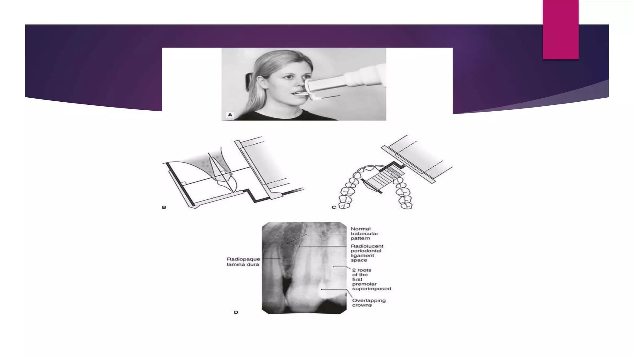 DENTAL X-RAYS-UNIT 4.pptx