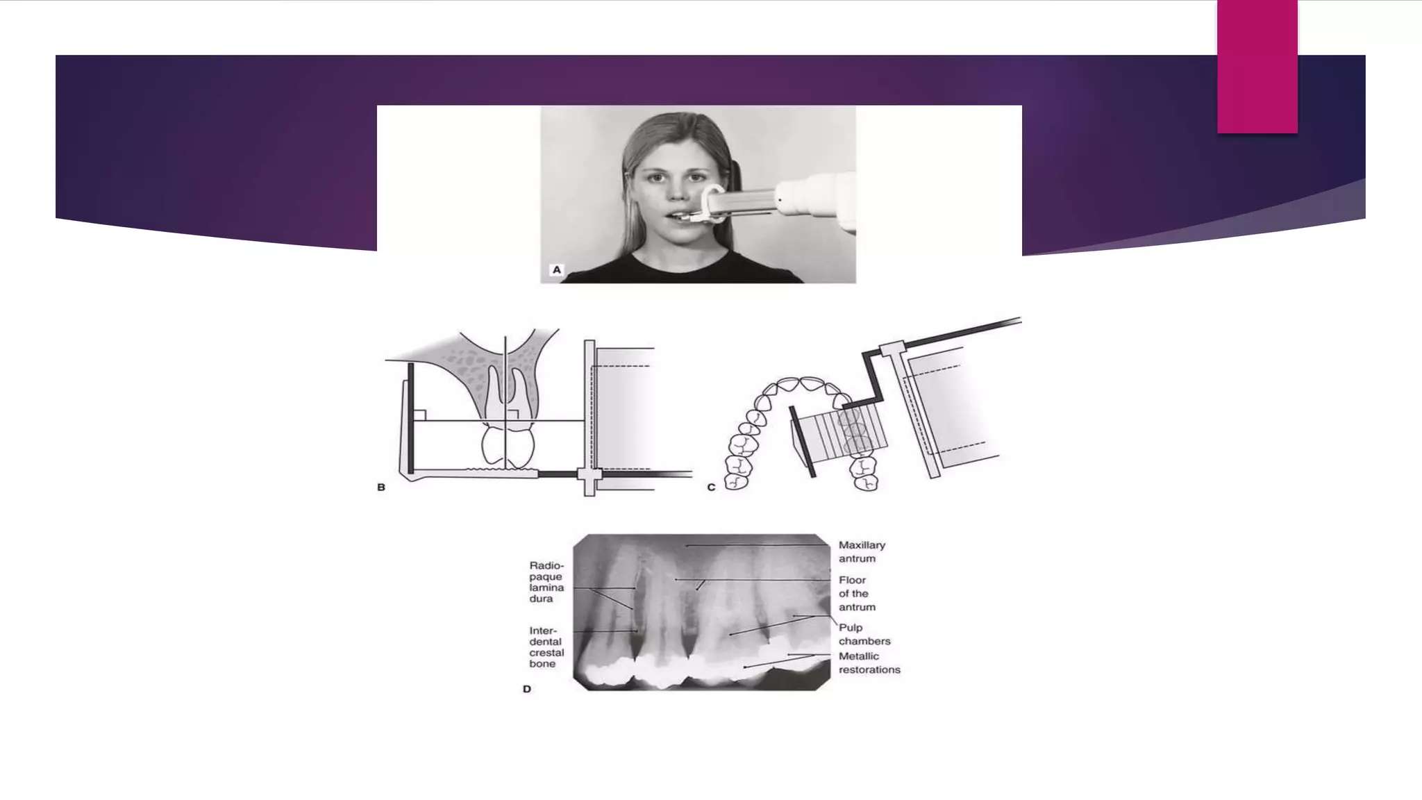 DENTAL X-RAYS-UNIT 4.pptx