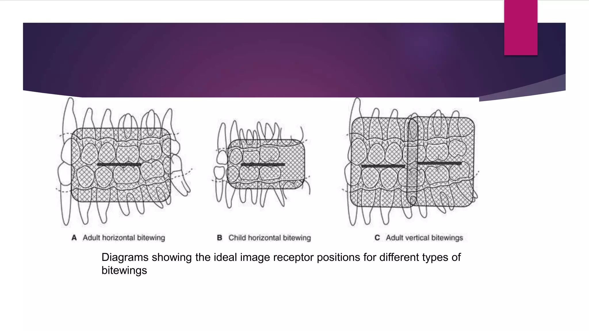 DENTAL X-RAYS-UNIT 4.pptx