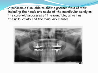 Dental X-ray Unit.pptx