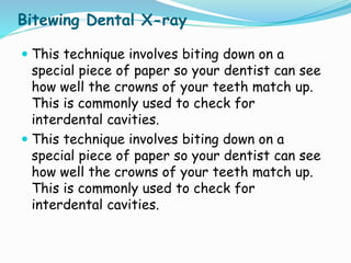 Dental X-ray Unit.pptx