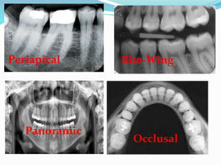 Dental X-ray Unit.pptx
