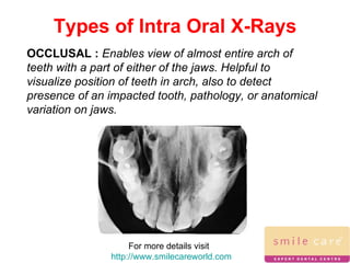 Dental X-Rays | PPT