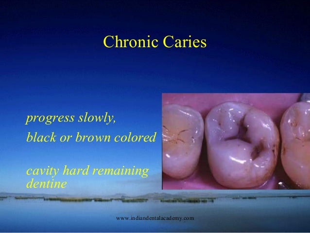 Dental caries/ oral surgery courses