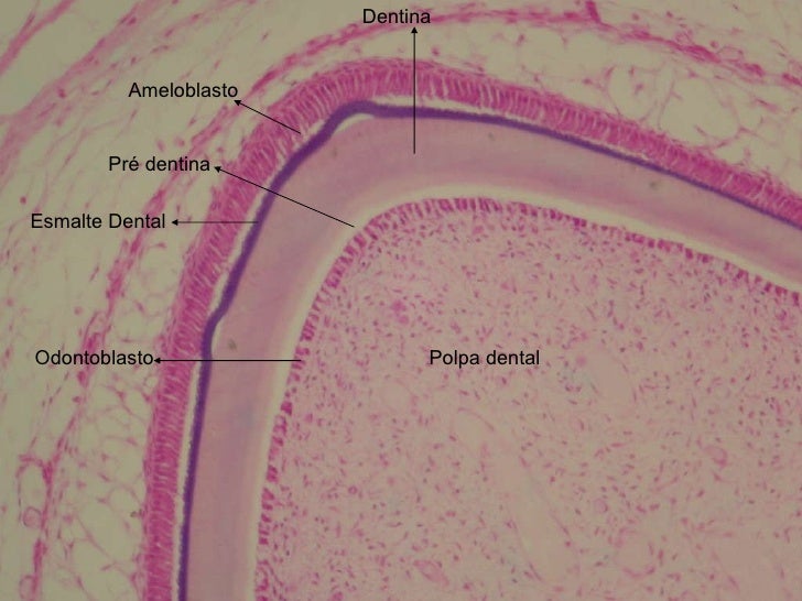 Dente