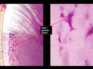 Dentenogenesis and histology of dentin | PPT