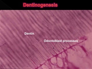 Dentenogenesis and histology of dentin | PPT