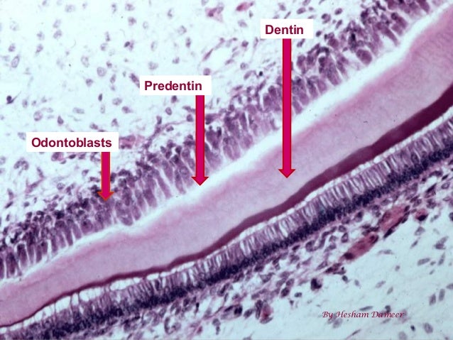 Dentenogenesis and histology of dentin