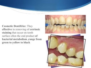 Dentifrices1 171216171009 | PPT