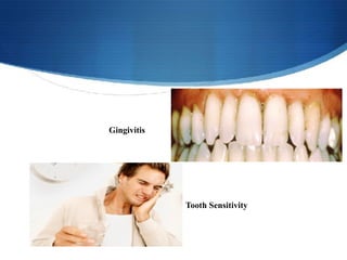 Dentifrices1 171216171009 | PPT