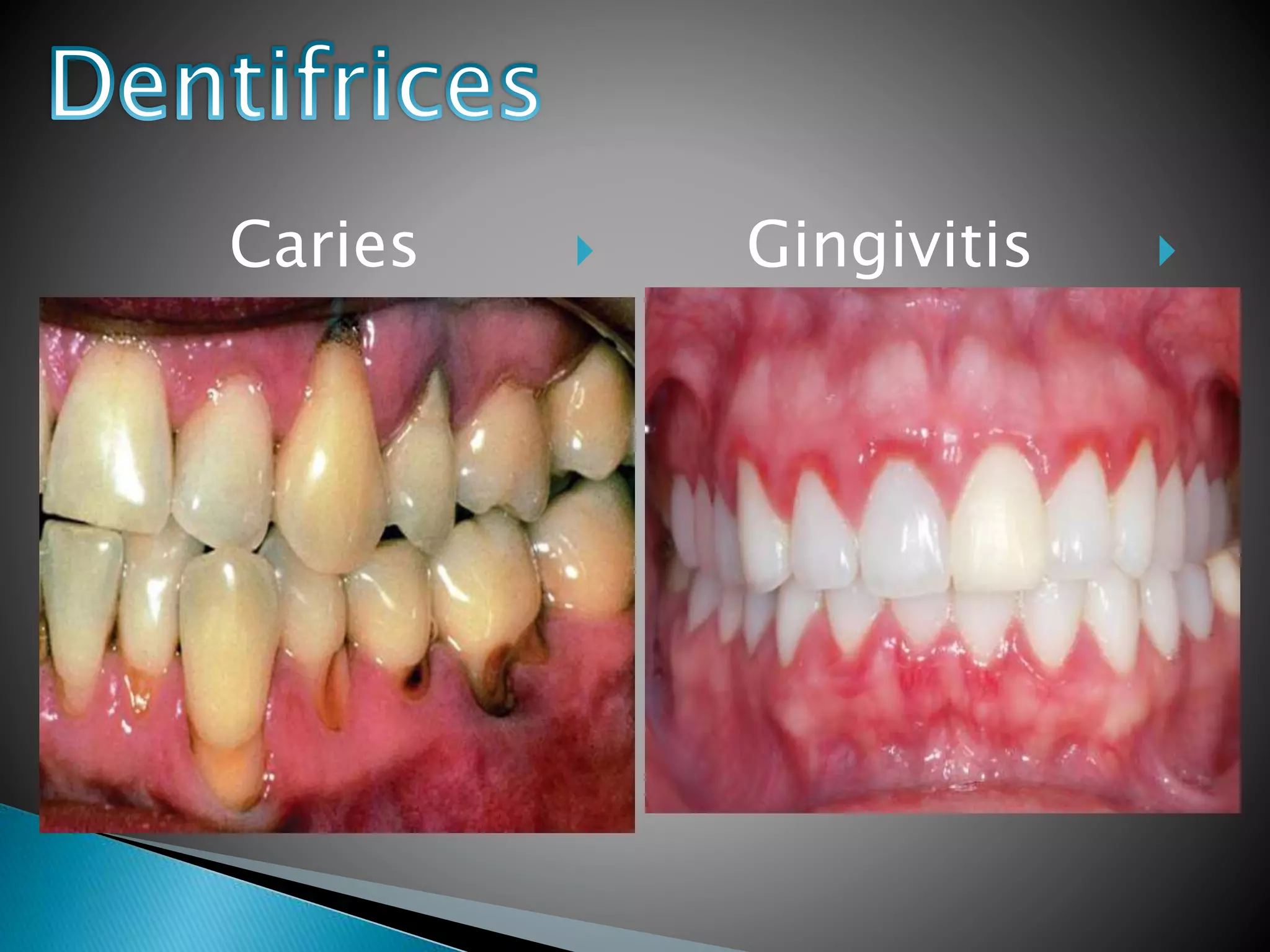 Dentifrices ppt222 | PPSX