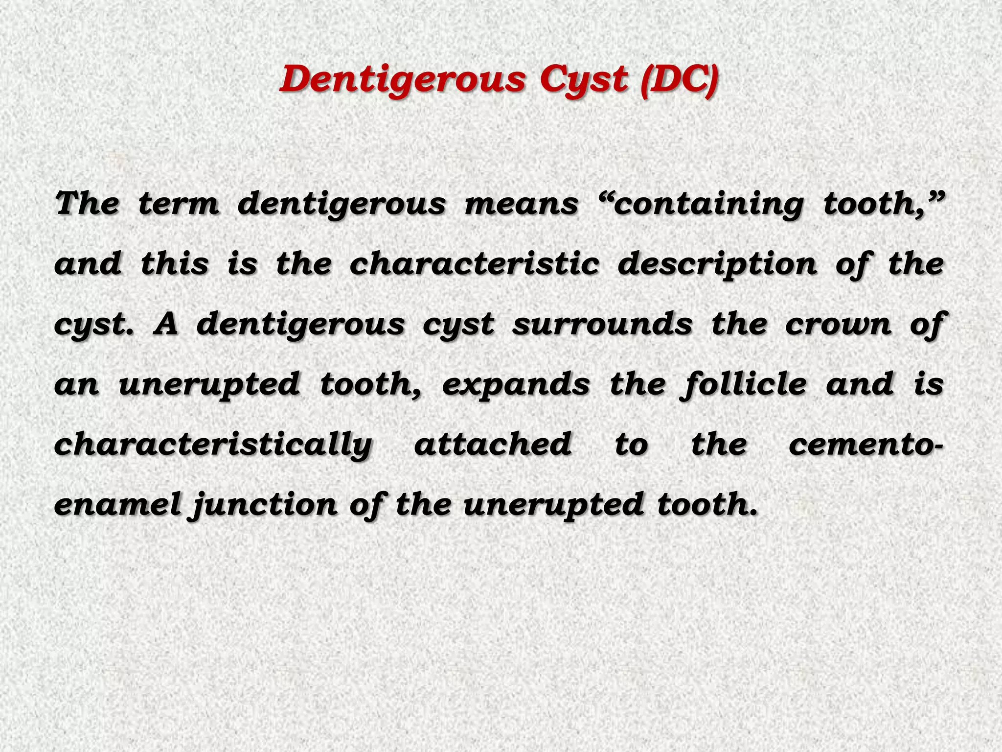 Dentigerous Cyst.ppt