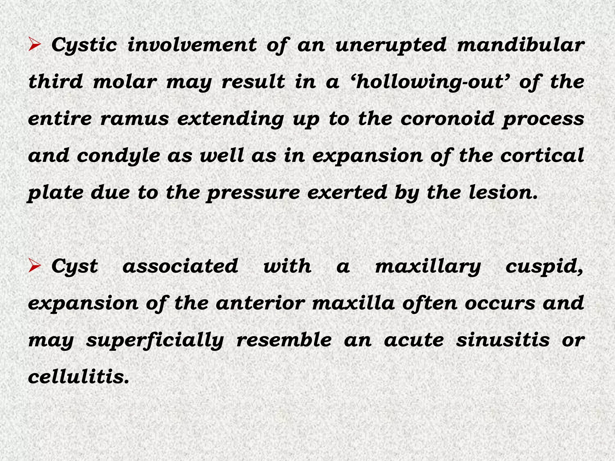 Dentigerous Cyst.ppt