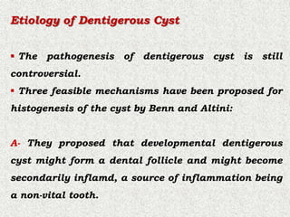 Pathogenesis Of Dentigerous Cyst Ppt