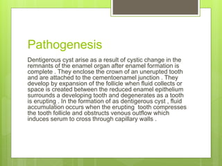 Pathogenesis Of Dentigerous Cyst