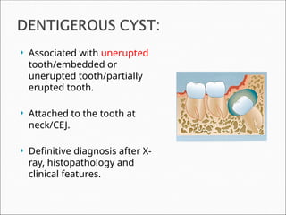 DENTIGEROUS CYST ORAL PATHOLOGY DENTISTRY | PPT