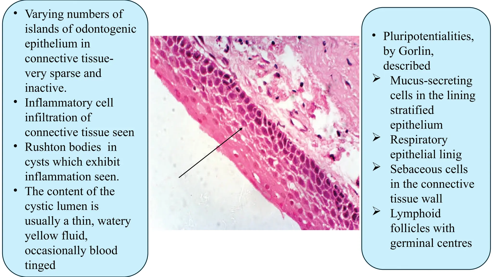 DENTIGEROUS CYST (FOLLICULAR CYST) PPT | PPTX